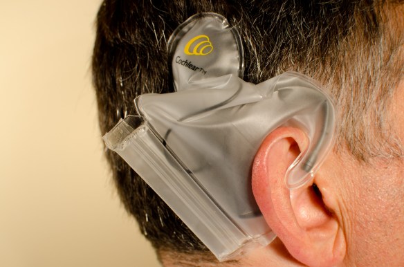 Cochlear Aqua Accessory Review | cochlear implant HELP