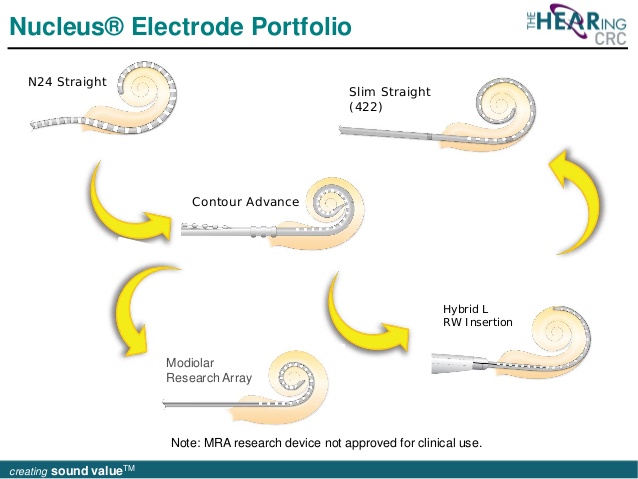 New Electrode Array for Cochlear | cochlear implant HELP