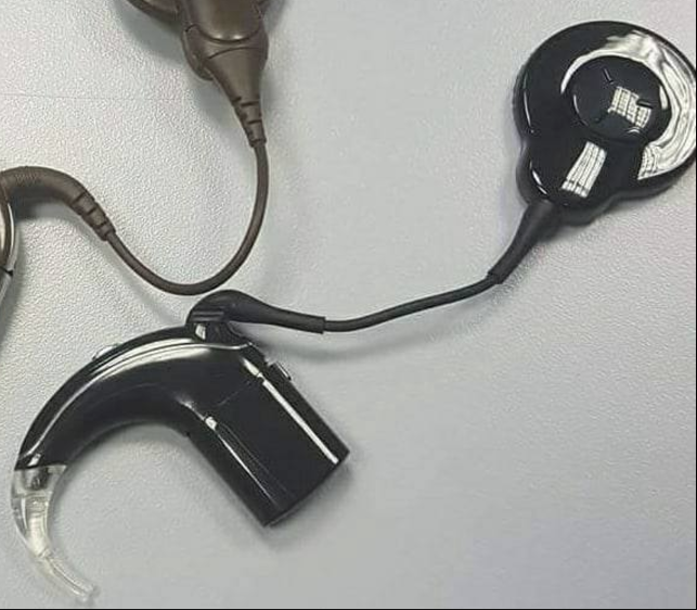 Nucleus 7 Spy Photo | cochlear implant HELP