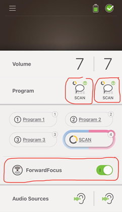 Cochlear Kanso 2 Processor Review | cochlear implant HELP